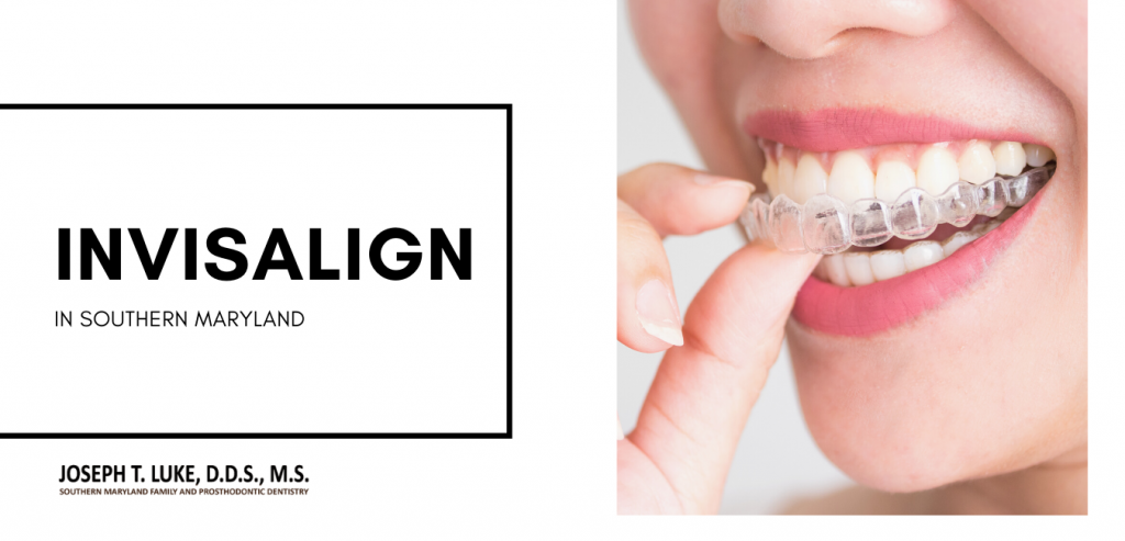 Invisalign